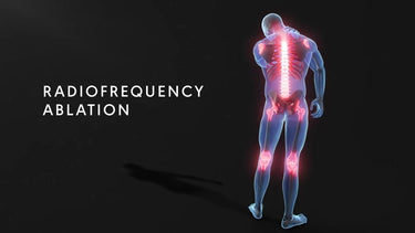 COOLIEF* COOLED RADIOFREQUENCY – Cairo Medical